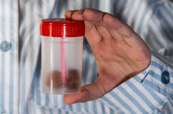 Stool Tests - Q Diagnostics